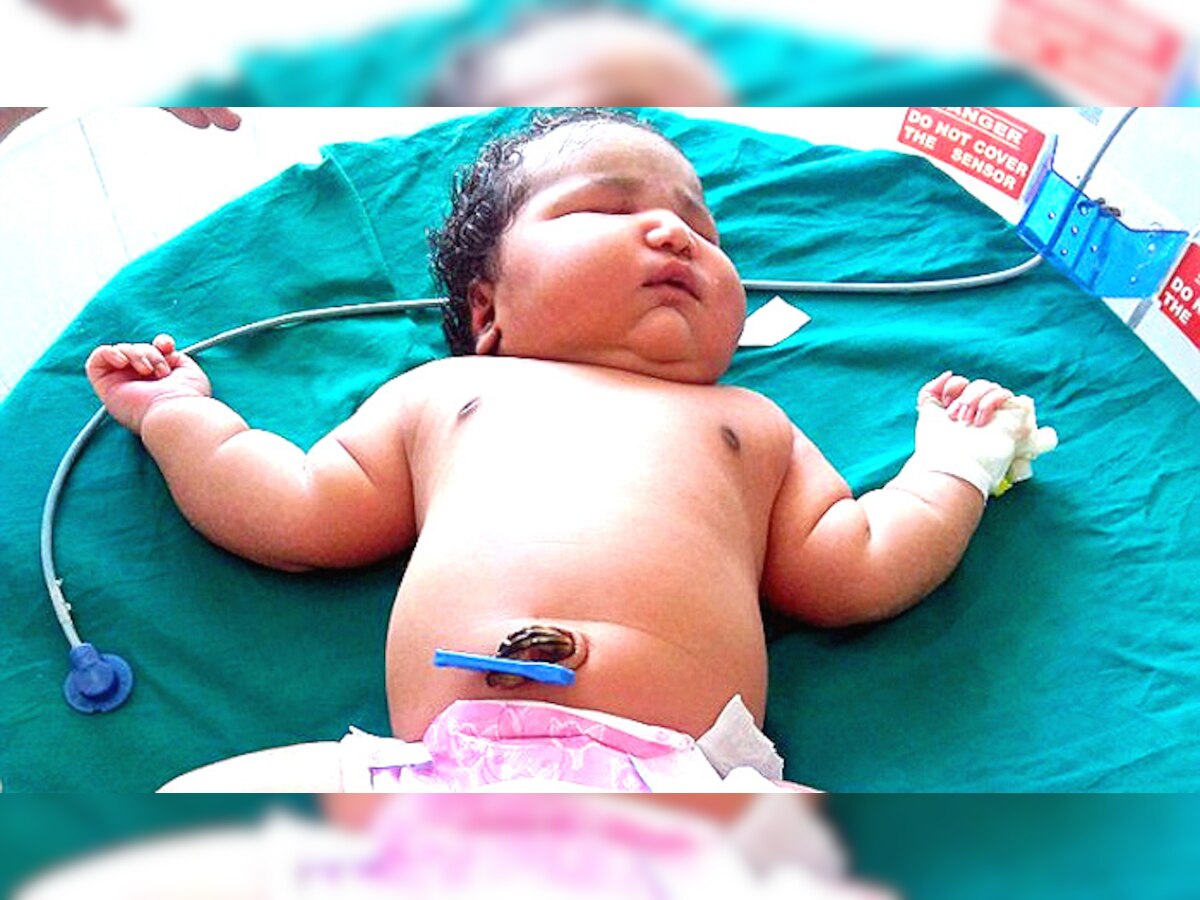 world's Weighing child born in haasan karnataka India | OMG: तो ये है ...