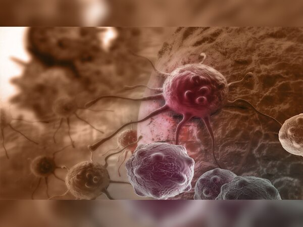 Scientist developed new method that can kill cancer cells in 2 hours ...