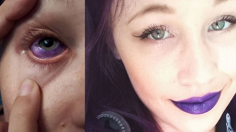 this Canadian model lost her eye sight after having tattoo in her eye ...