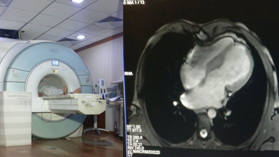 Ganga Ram Hospital doctors developed MRI and CT Scan technology detects ...