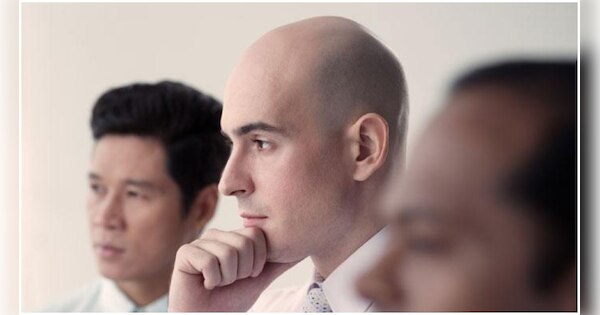 study confirms bald men being intelligent and handsome | अगर गंजे हैं ...