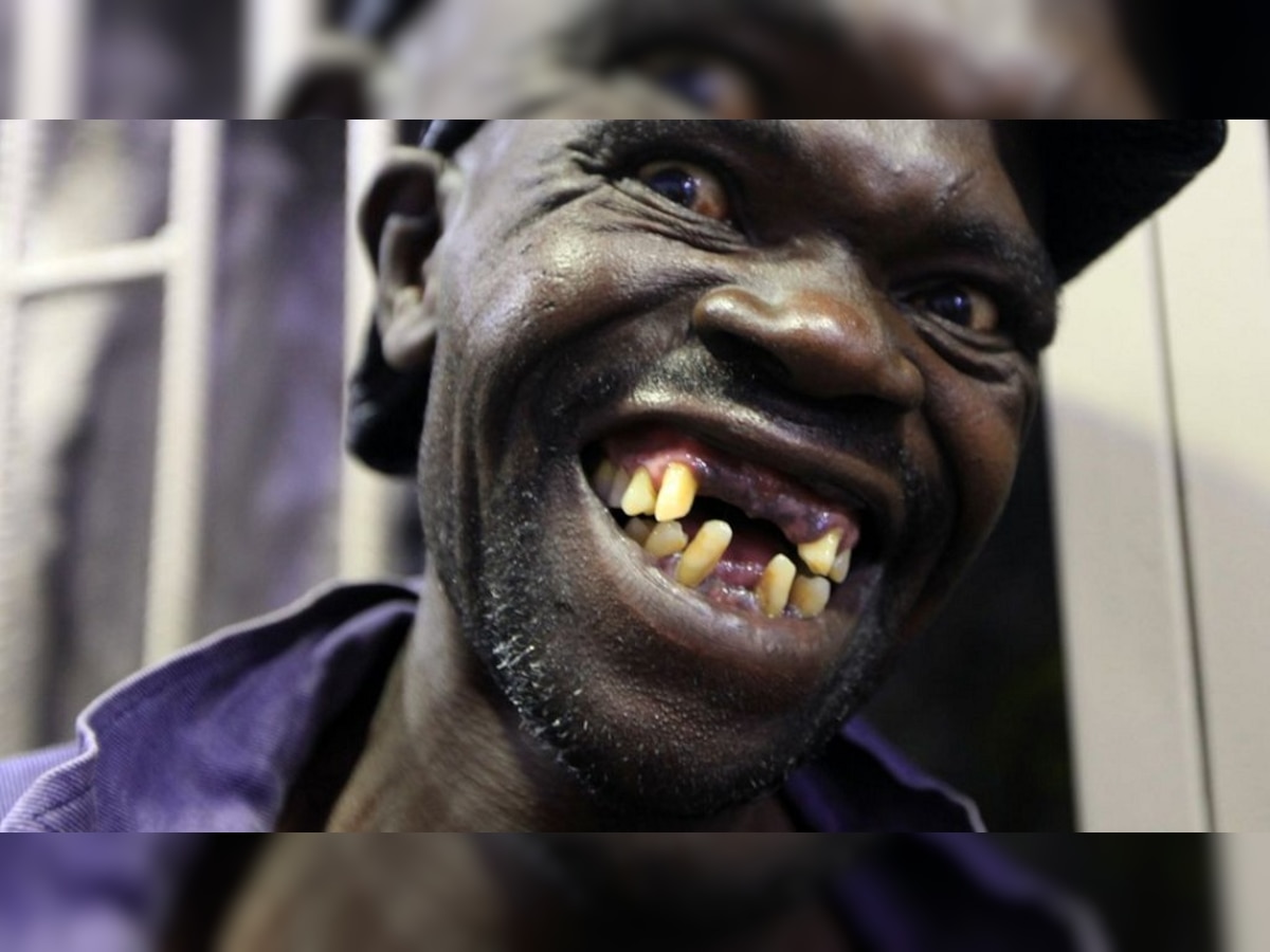 top most ugliest people in the world | Ugliest People: ये हैं दुनिया के ...