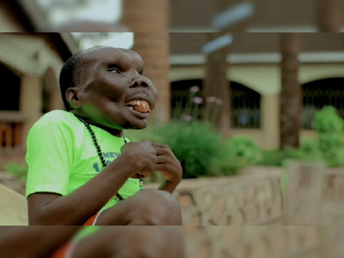 top most ugliest people in the world | Ugliest People: ये हैं दुनिया के ...