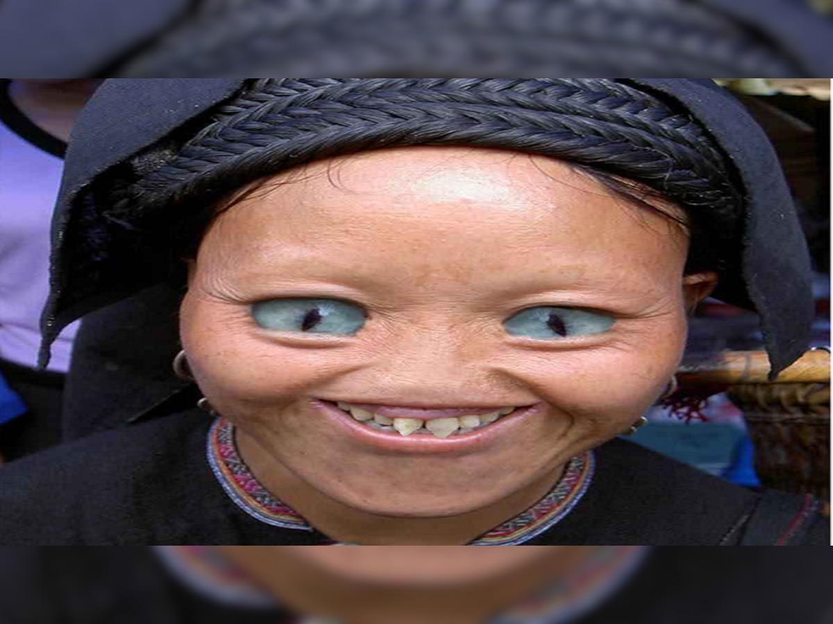 top most ugliest people in the world | Ugliest People: ये हैं दुनिया के ...