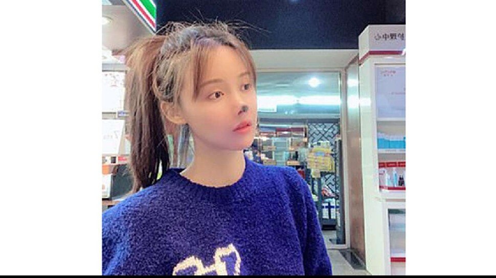 Chinese singer Gao Liu went through nose surgery shocking pictures ...