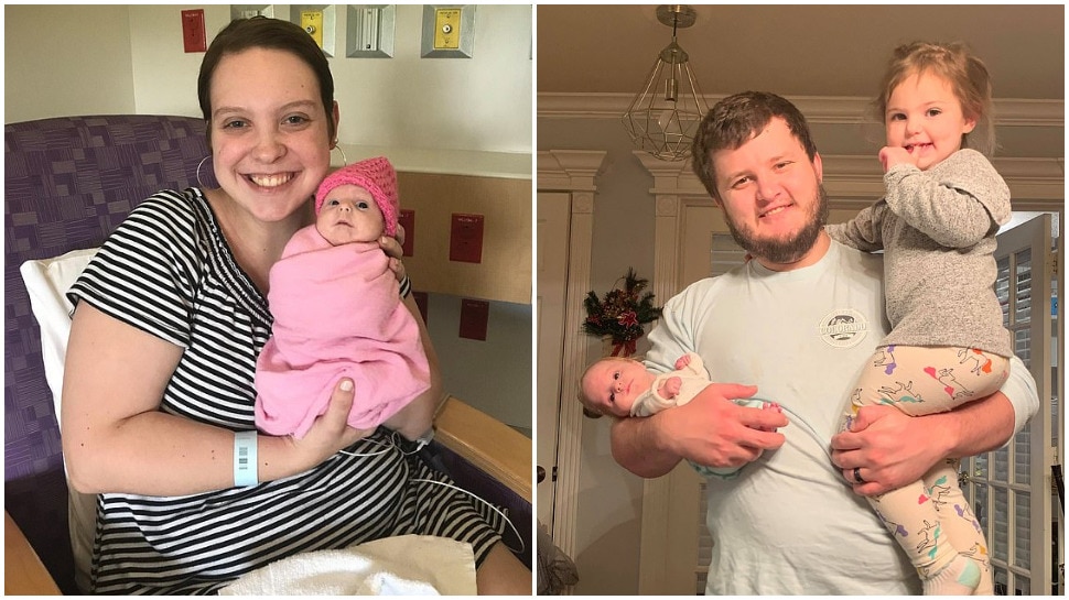 weird news tiny toddler is born with rare form of dwarfism disability ...