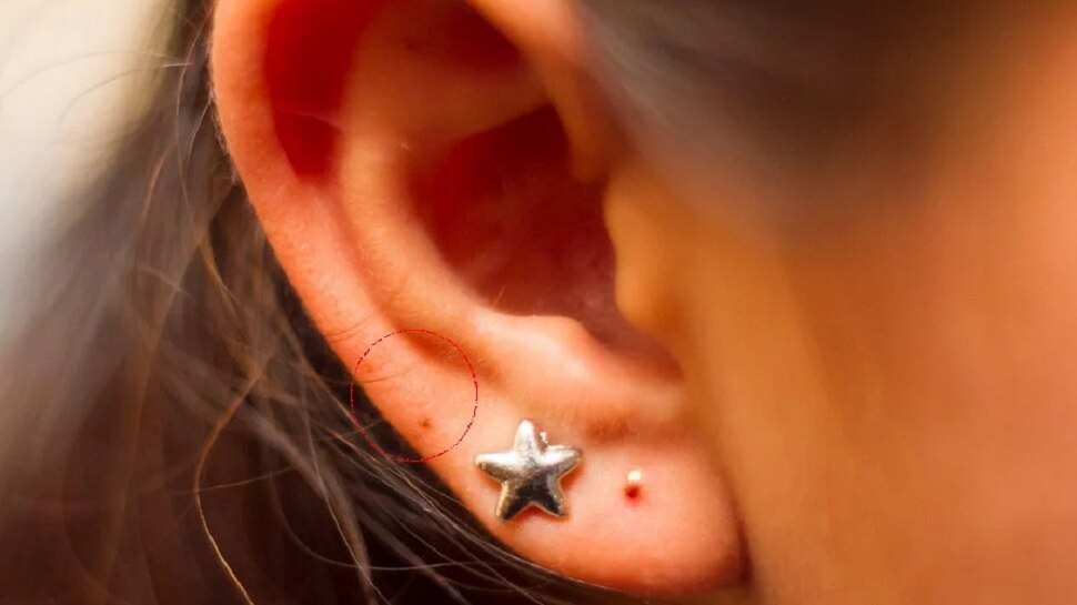 jyotish mole on ears know according to samudrik shastra know mole on ...