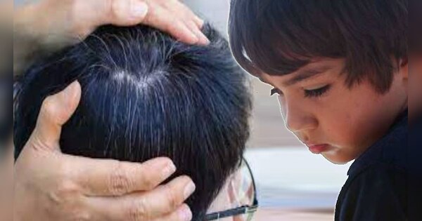 causes of white hair in kids know home remedies of white hair problem ...