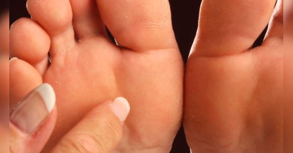 foot palmistry meaning of feet line and special Sign and symbol ...