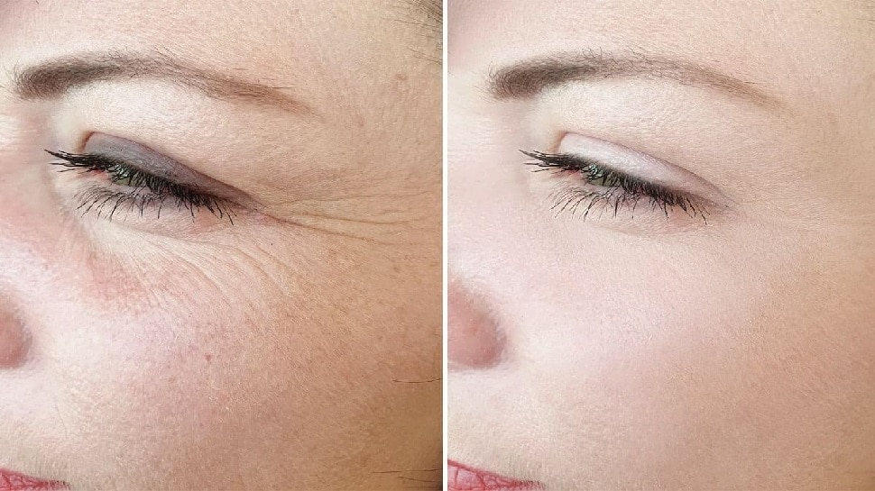 skin aging around eyes habits that are aging your eyes | इन गलतियों से ...