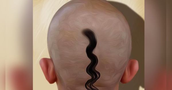 shikha choti significance according to sushruta samhita | आखिर क्यों ...