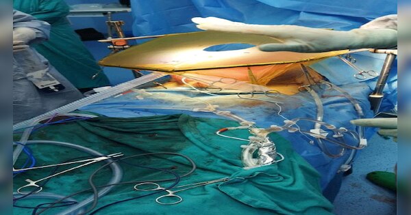 Stomach cancer successfully treated with state-of-the-art HIPEC ...