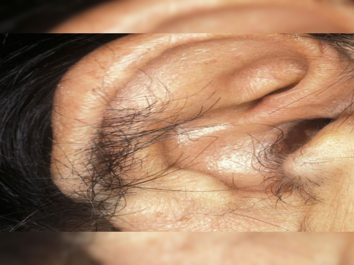 samudrik shastra what does hair on ear indicates | जिनके कान पर होते ...