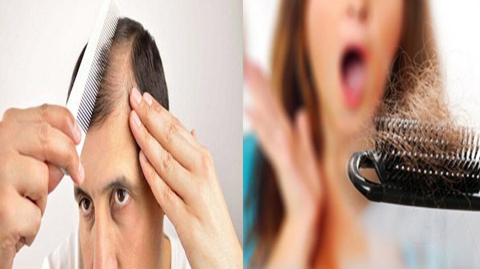 Hairfall shampoo is fail in front of these things start doing today to ...