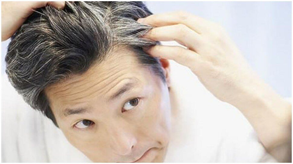 hair care tips tips to get rid of the problem of white hair White Hair ...