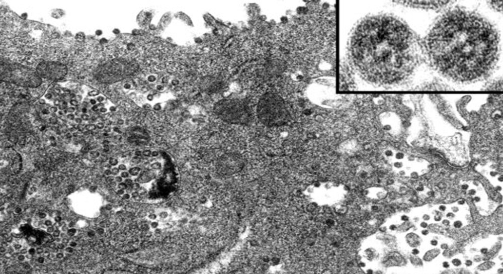 1159227-monkeypox.gif?imwidth=1200&imheight=900