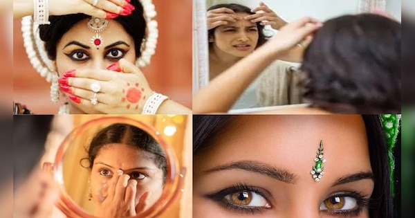 know Remedies for skin allergy caused after removing bindi from head ...