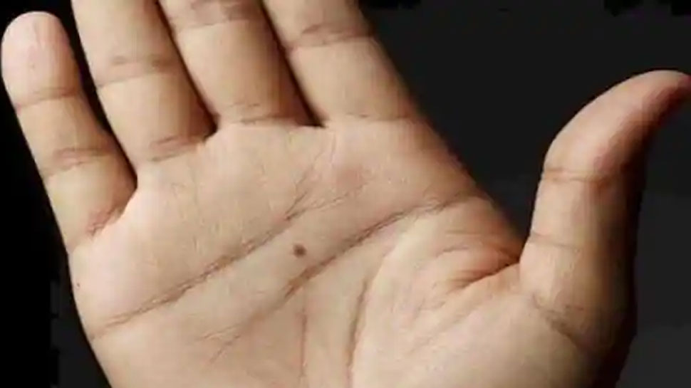 mole on your hand tells your destiny and nature, know what the ...