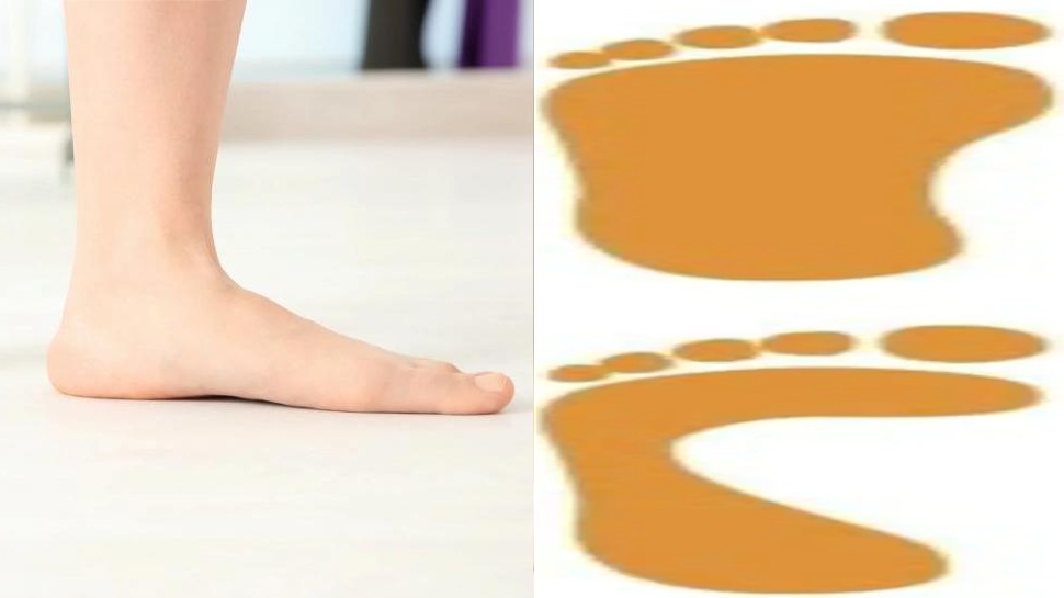 Flat Foot People Ban In Indian Army Samtal Pair Walon Ko Sena Mein Nhi flat-foot-people-ban-in-indian-army-samtal-pair-walon-ko-sena-mein-nhi