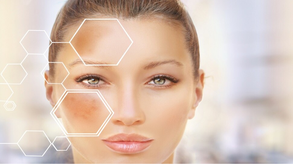 Skin Care Tips to Remove Forehead Darkening Know How to Treat Dark ...