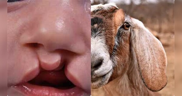 Goat bone will cure deformities like cleft lips and curved ears | कटे ...