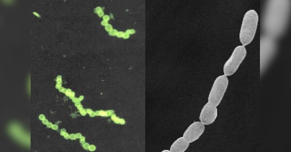 World largest bacteria Thiomargarita magnifica discovered large enough ...