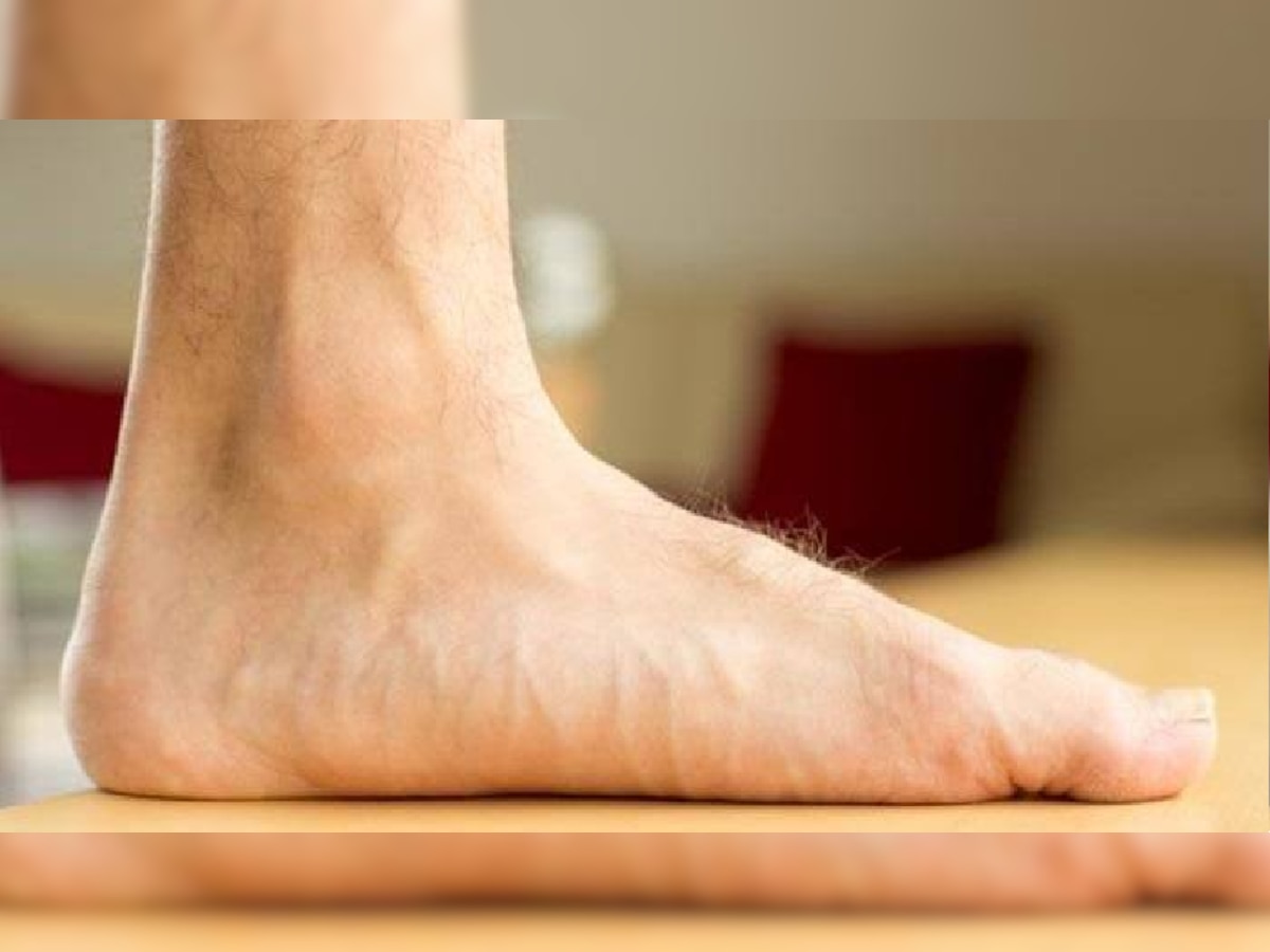 Indian Army why flat foot people are not allowed in army know the reason