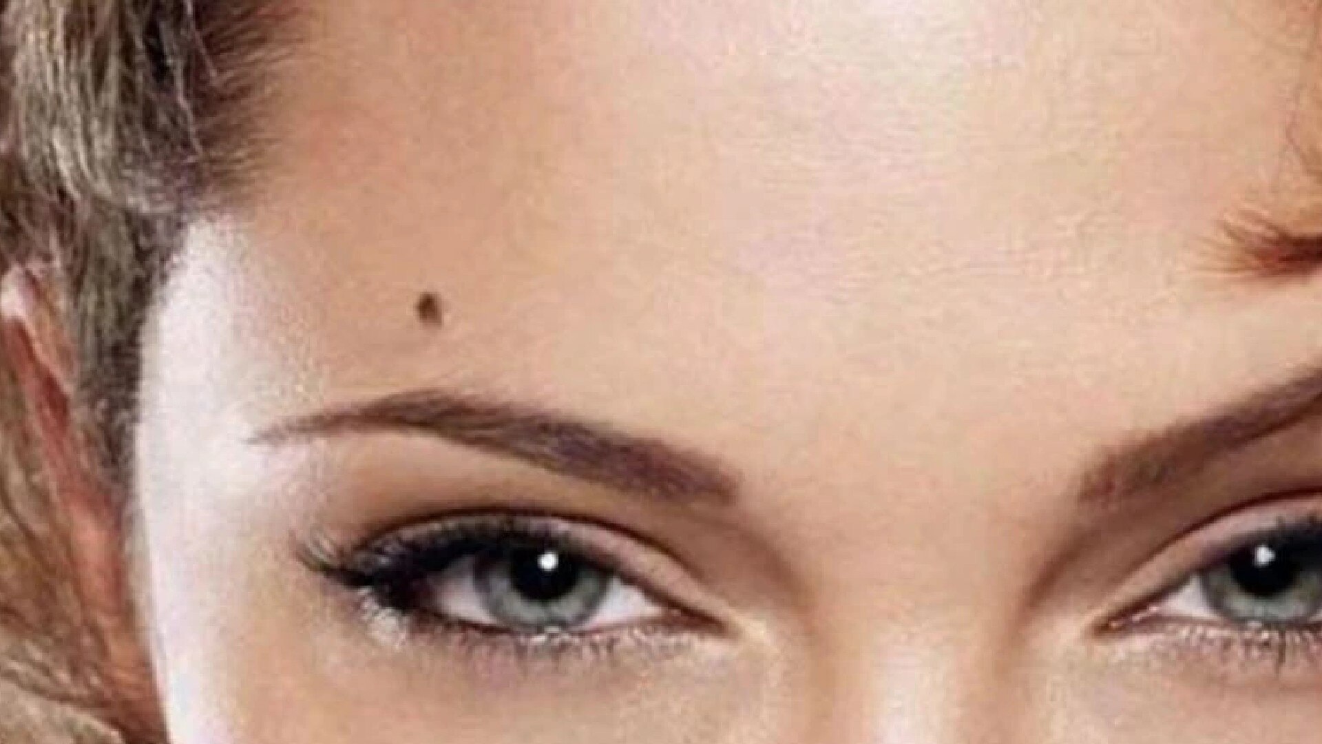 People moles on these 5 parts they live a luxury life apmp | Moles On ...