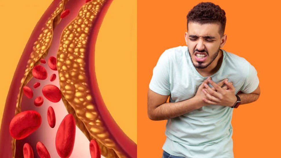 Bad High Cholesterol Warning Sign Chest Pain Obesity Leg Pain Yellow ...