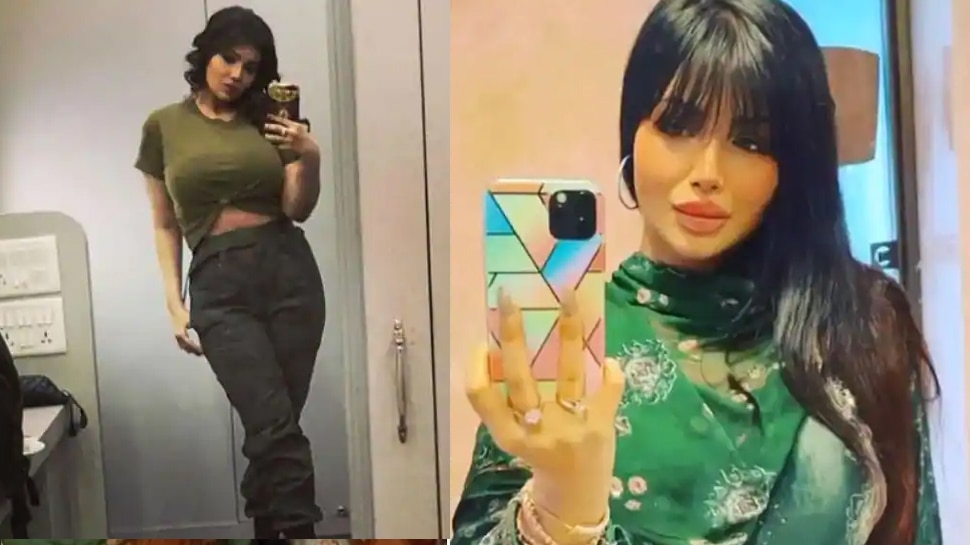 Ayesha Takia pictures after surgery viral bollyood celebrity plastic ...