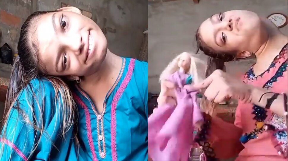 pakistani girl afsheen gul neck stuck in painful condition up to 90 ...