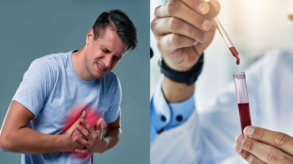 Troponin T Test For Heart Attack Cardiac Arrest Coronary Artery Triple ...