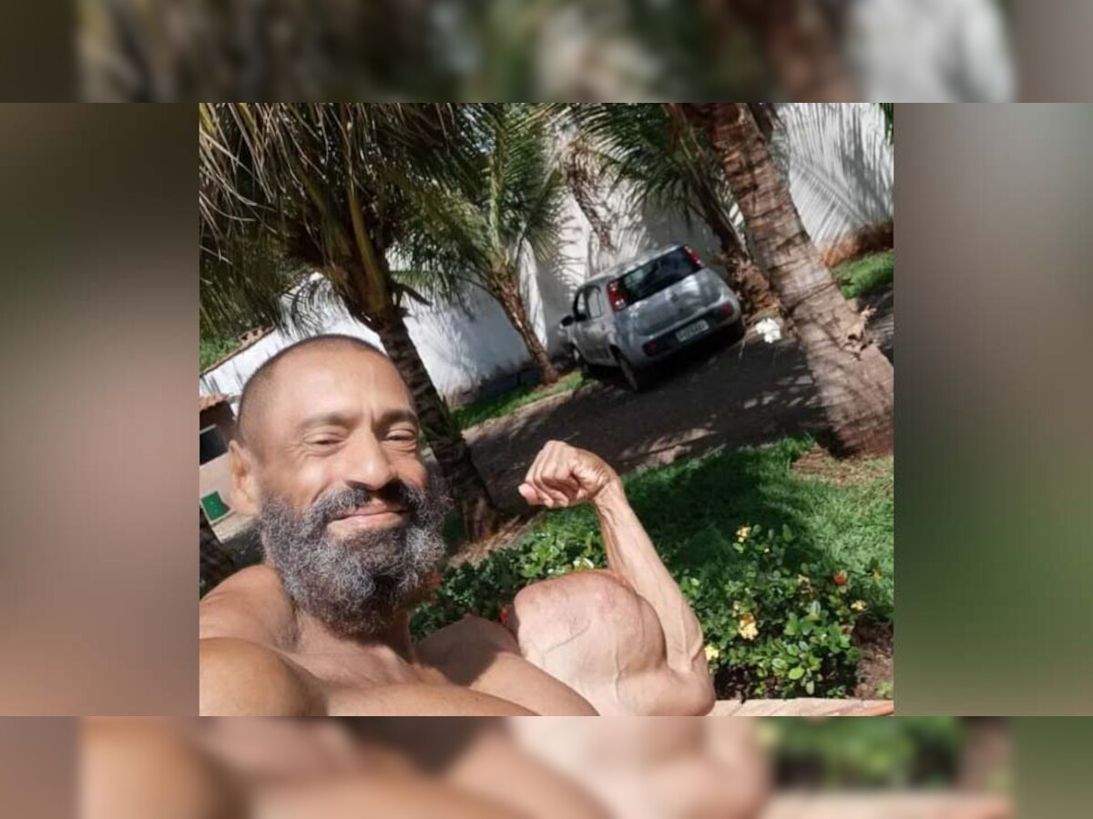 hulk bodybuilder valdir segato died brazil see his shocking cosmetic ...