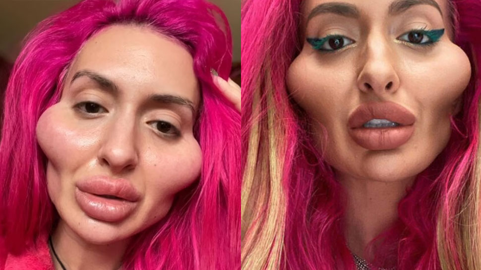 World Biggest Cheeks of Anastasia Pokreshchuk Netizens Shocked After ...