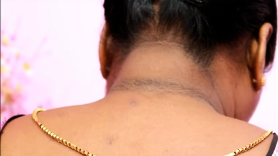 how to clean neck tanning Remedies for Dark Neck neck tanning | Dark ...