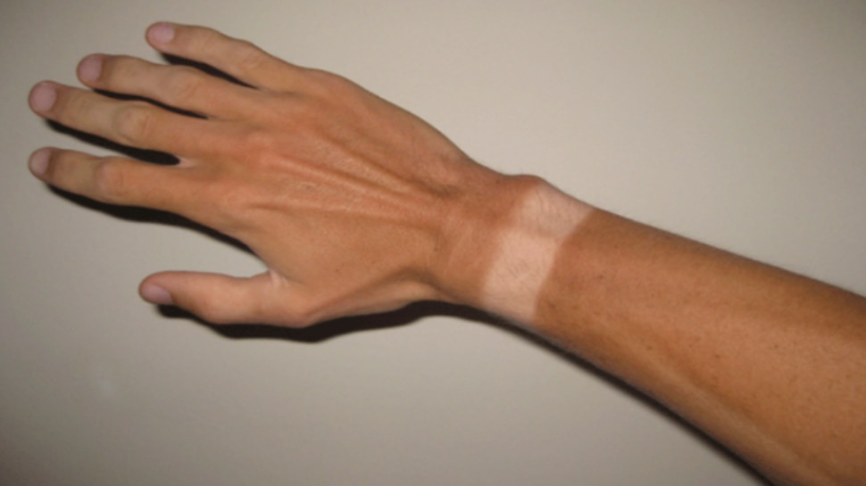 Sun Tanning on hands Try this simple home remedy skzs | अगर धूप से आ गई ...