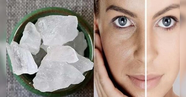 Alum gives relief in many problems with injury Alum Health benefits use ...