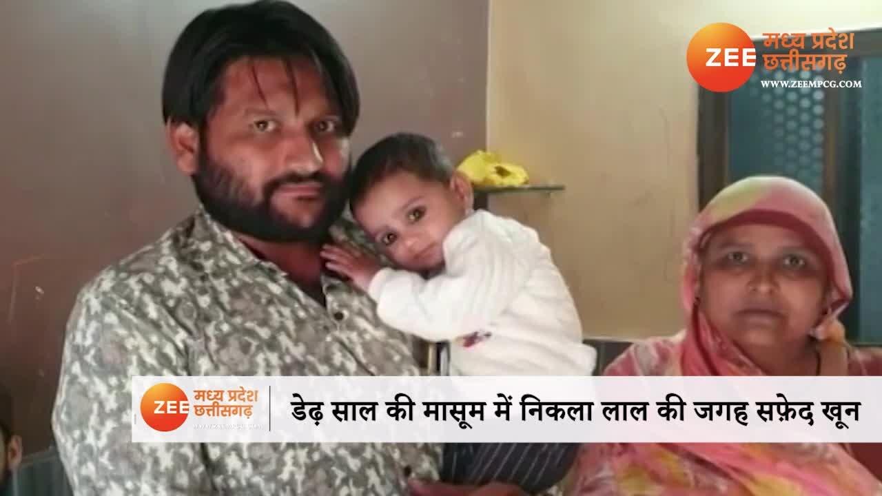 badwani rare case innocent baby girl blood color white know unique case ...