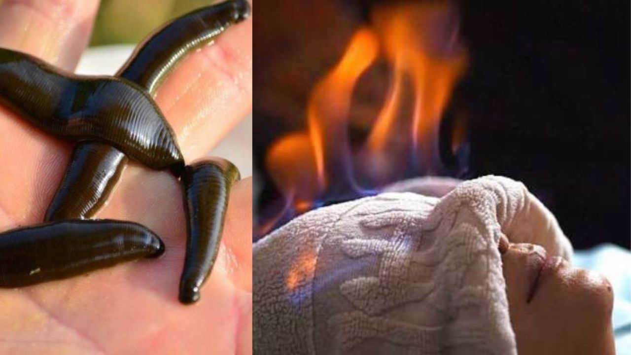 know about these unique type of fire leech salt therapy Unusual ...