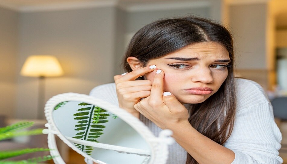 Pimple Removal Tips Pimples Will Disappear Overnight Using These Things ...