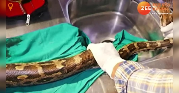 python stomach operation done in chhindwara doctors did surgery ajgar ...