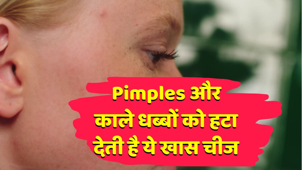 Beauty tips Get rid of pimples and dark spots with this special seed ...