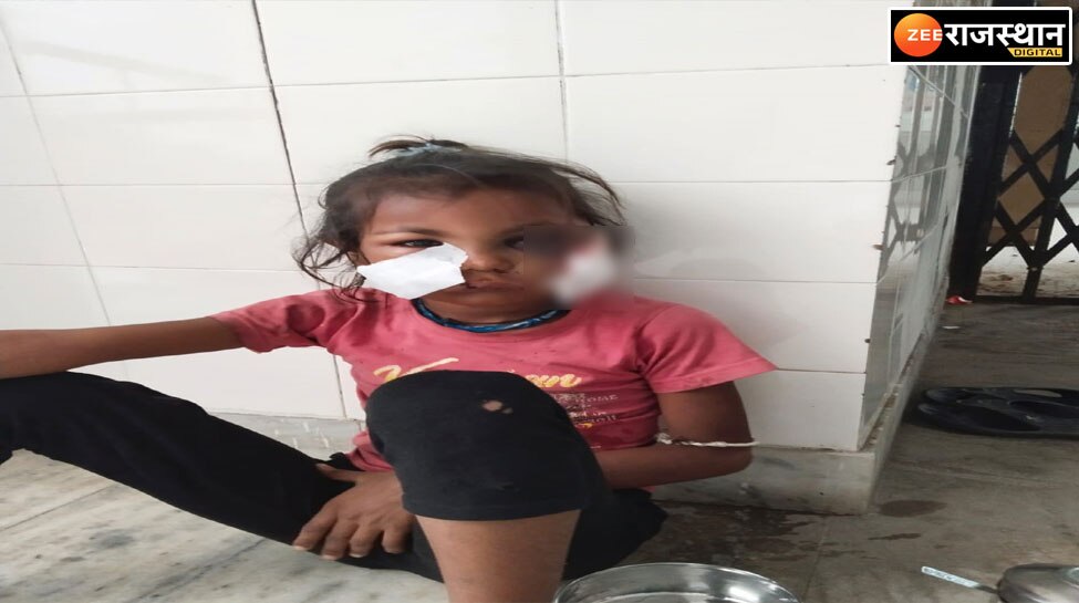 Mandal dog scratched cheek and mouth of 9 year old girl died during ...