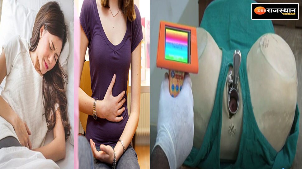 Cervical cancer treatment will be easy Siri scientists developed ...