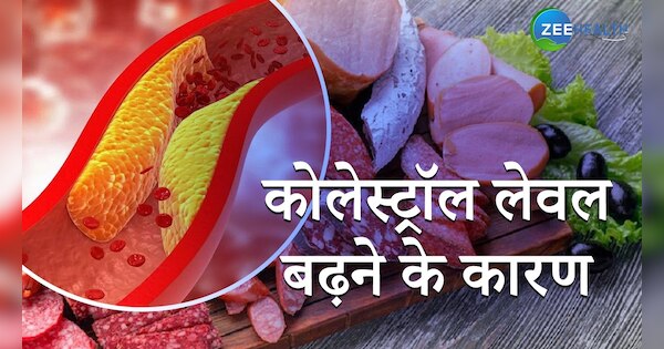 Bad cholesterol: These things gradually increase cholesterol level in ...