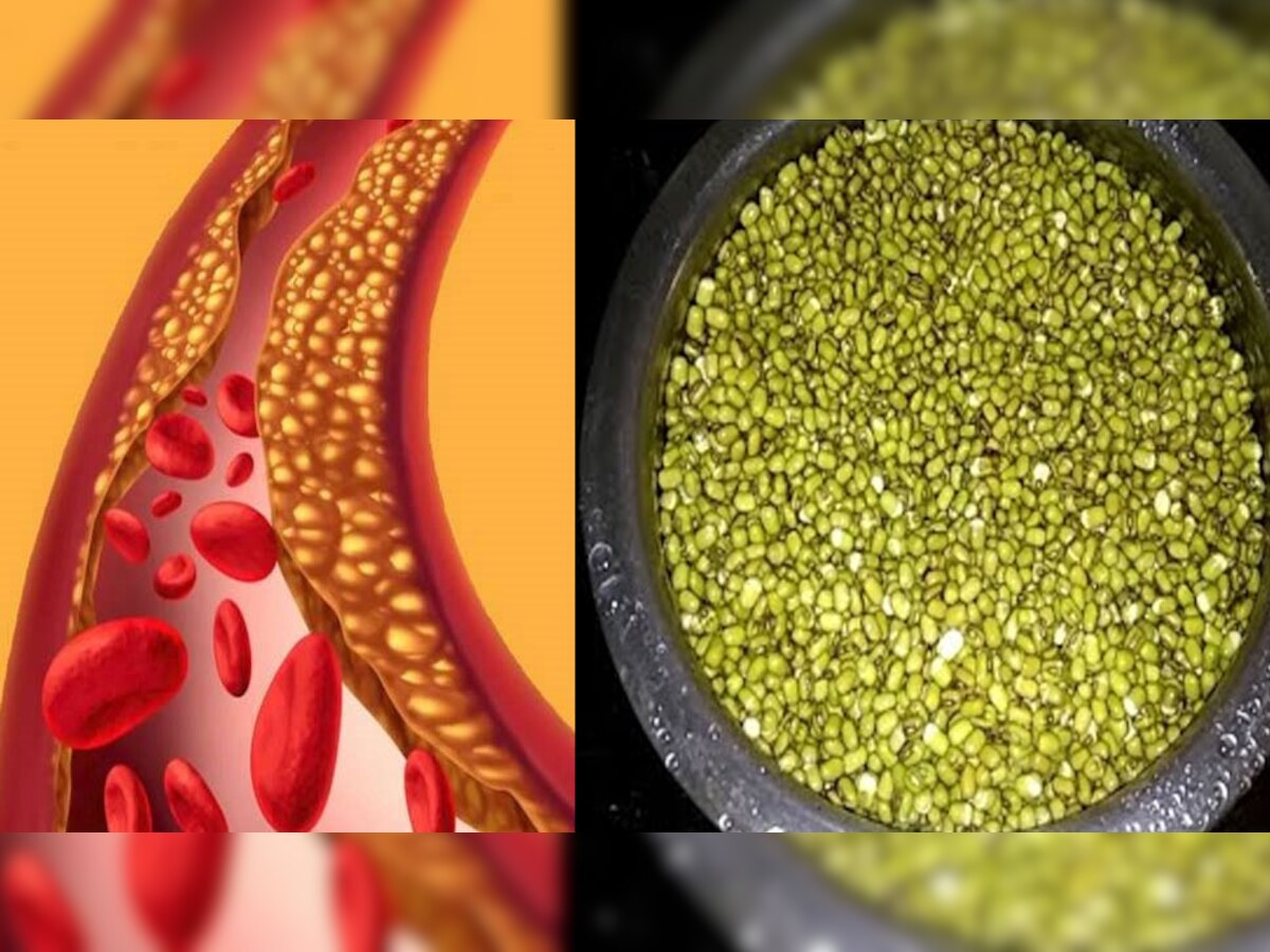 Best Daal Lentils For High Cholesterol Masoor Moong Vigna mungo Urad ...