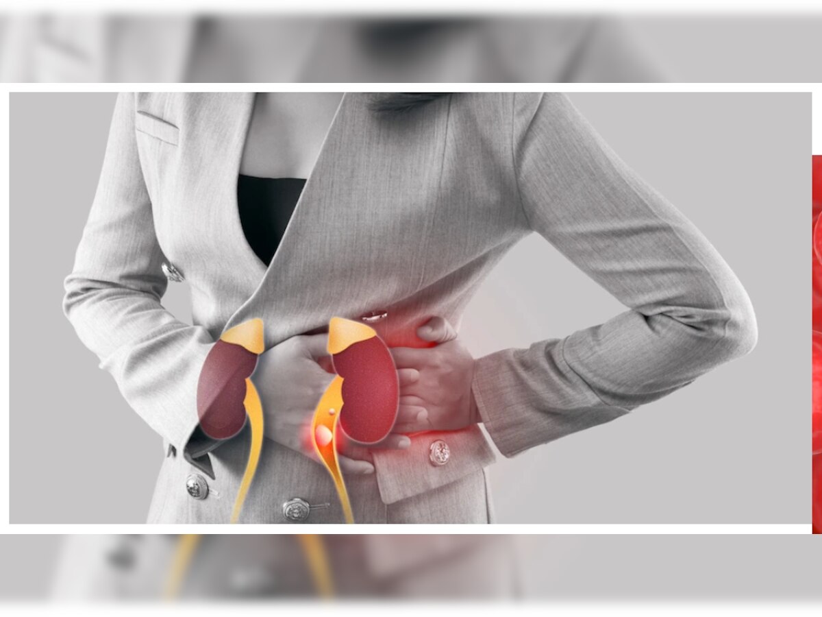 Kidney Care Tips these habits can be dangerous for kidney | Kidney ...