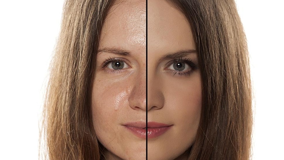 what can be the reason for oily skin know home remedies to improve ...
