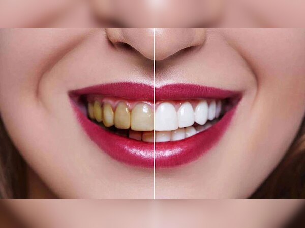 how to clean teeth naturally with home made herbal powder | Teeth ...