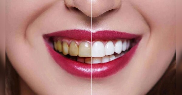 how to clean teeth naturally with home made herbal powder
